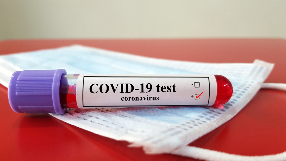 PREP Act Immunity for Pharmacists Ordering COVID-19 Tests: New HHS OGC ...